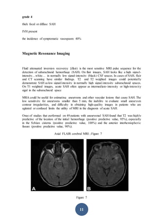 Subarachnoid hemorrhage imaging | DOCX | Blood Disorders | Diseases and Conditions