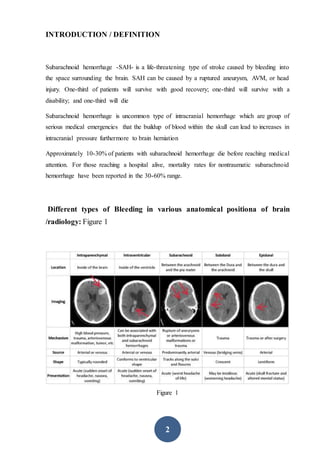 Subarachnoid hemorrhage imaging | DOCX | Blood Disorders | Diseases and Conditions
