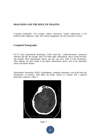 Subarachnoid hemorrhage imaging | DOCX | Blood Disorders | Diseases and Conditions