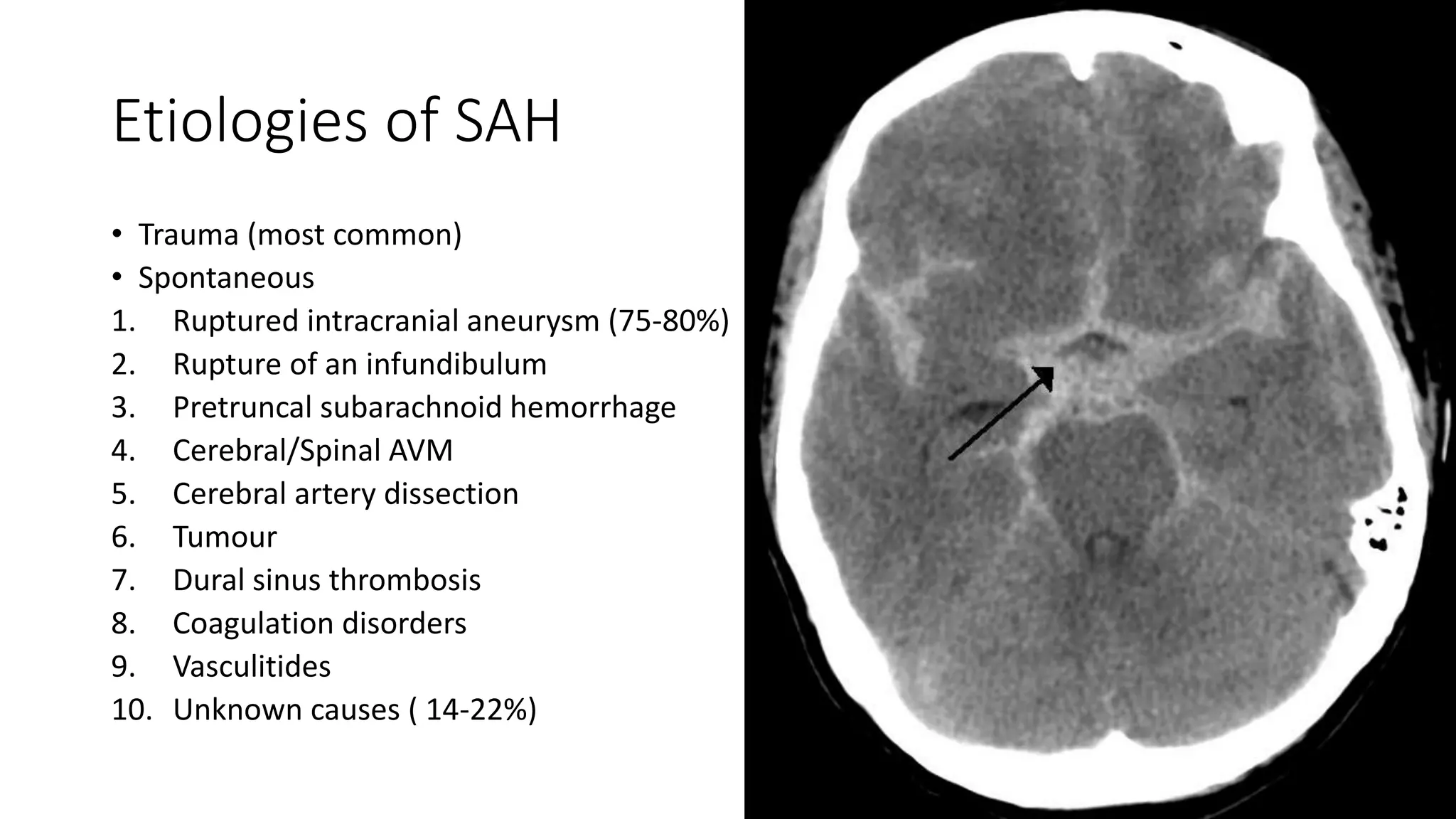 Subarachnoid Hemorrhage (SAH) and Aneurysm presentation.pptx