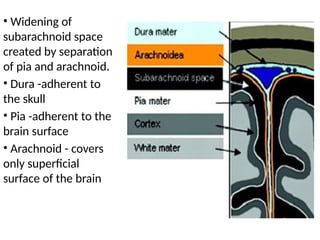 SUBARACHNOID SPACES - the CSF Cisterns.pptx