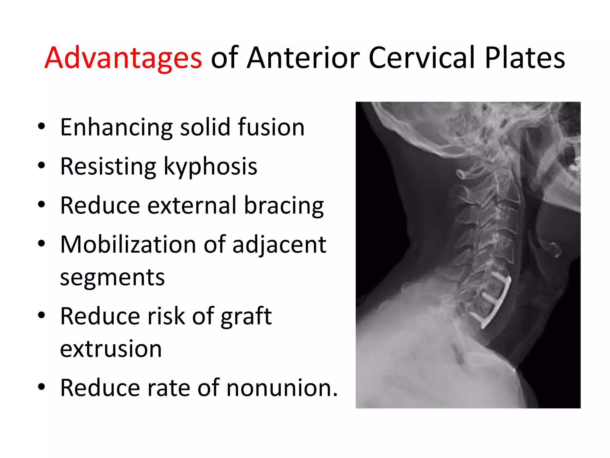 Subaxial cervical fixation techniques | PPTX
