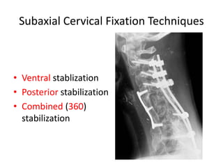 Subaxial cervical fixation techniques | PPTX