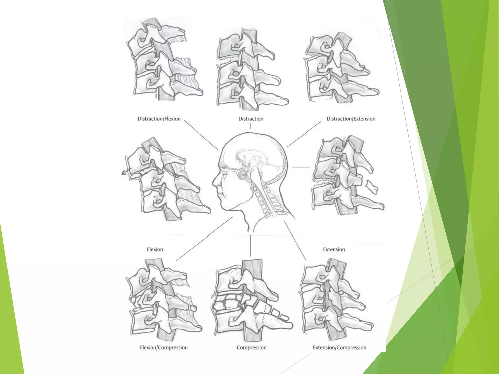 subaxial cervical fx VI.pptx