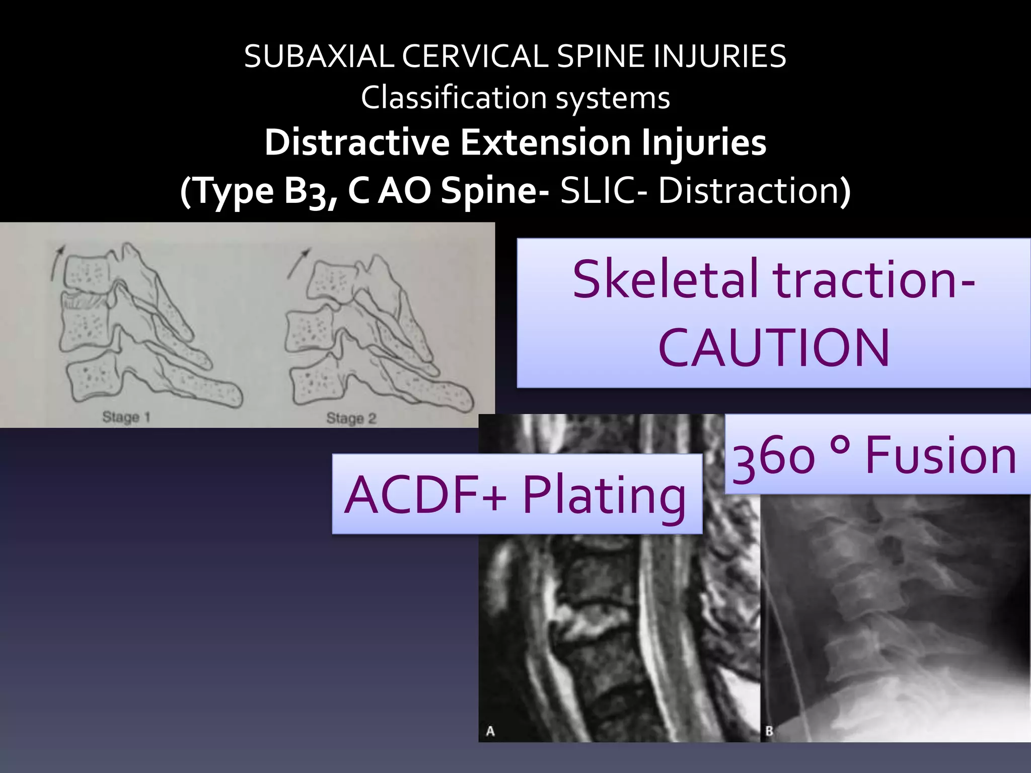 Subaxial cervical spine injuries clinical specturum and emergency ...