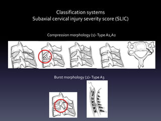 Subaxial cervical spine injuries clinical specturum and emergency ...