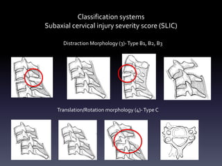 Subaxial cervical spine injuries clinical specturum and emergency ...