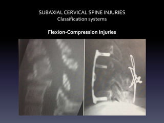 Subaxial cervical spine injuries clinical specturum and emergency ...