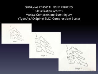 Subaxial cervical spine injuries clinical specturum and emergency ...