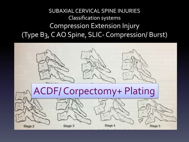 Subaxial cervical spine injuries clinical specturum and emergency ...