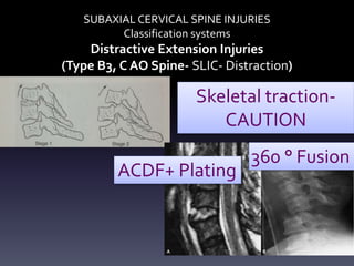 Subaxial cervical spine injuries clinical specturum and emergency ...