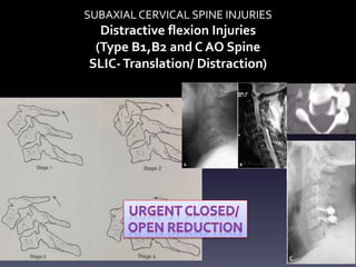 Subaxial cervical spine injuries clinical specturum and emergency ...