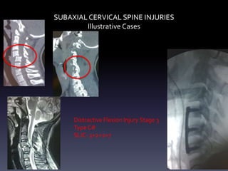 Subaxial cervical spine injuries clinical specturum and emergency ...