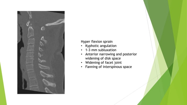 Sub Axial Cervical Spine Trauma and its classification | PPT