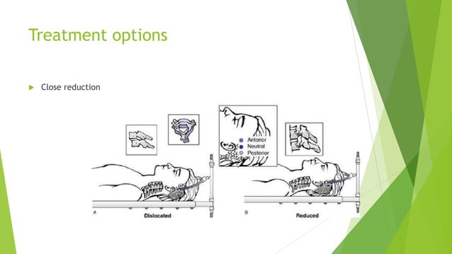 Sub Axial Cervical Spine Trauma and its classification | PPT