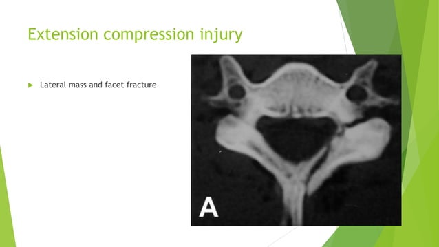 Sub Axial Cervical Spine Trauma and its classification | PPT