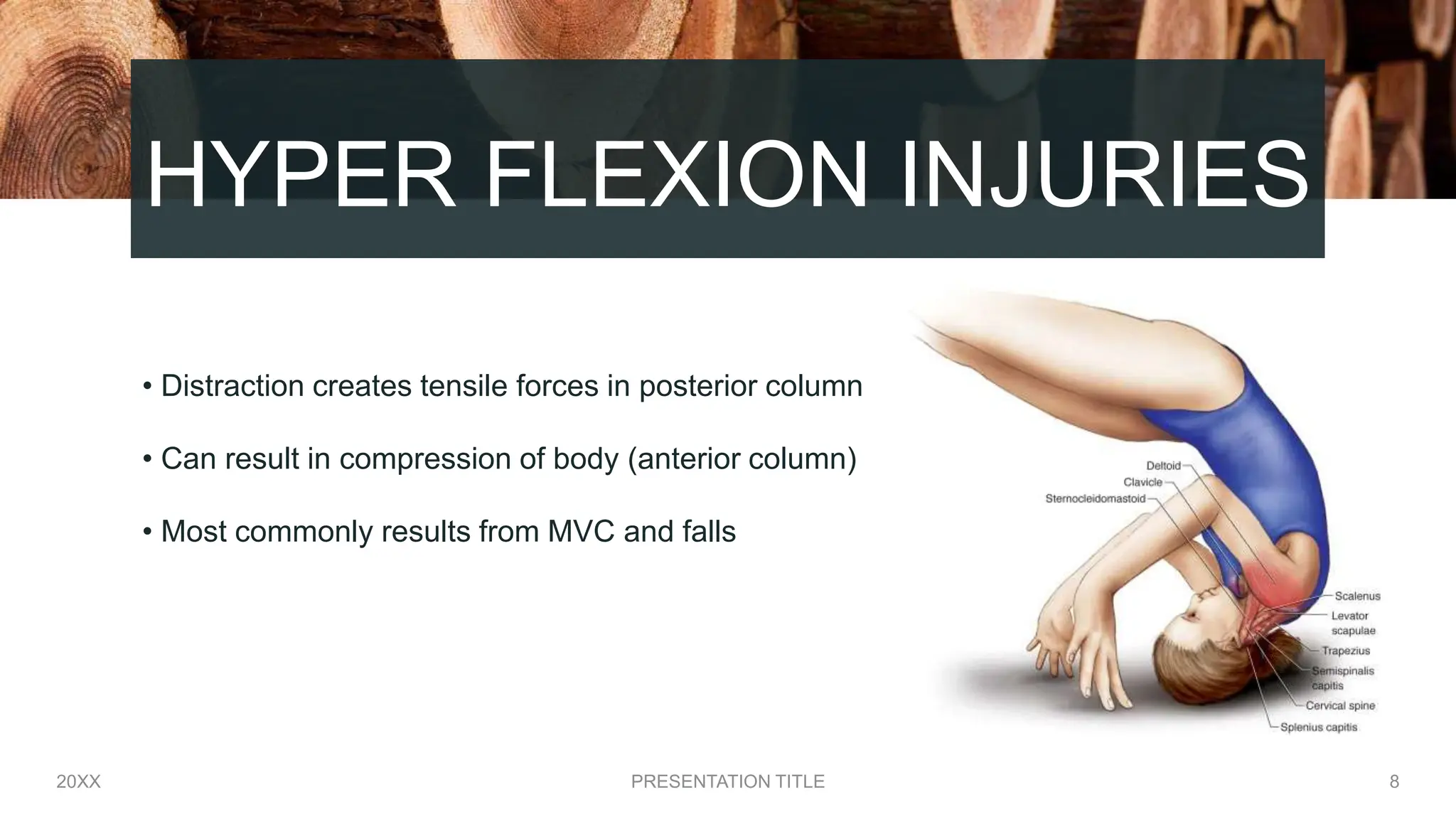 SUBAXIAL SPINE INJURY BY DR NKUNDIMANA JEAN PAUL .pptx