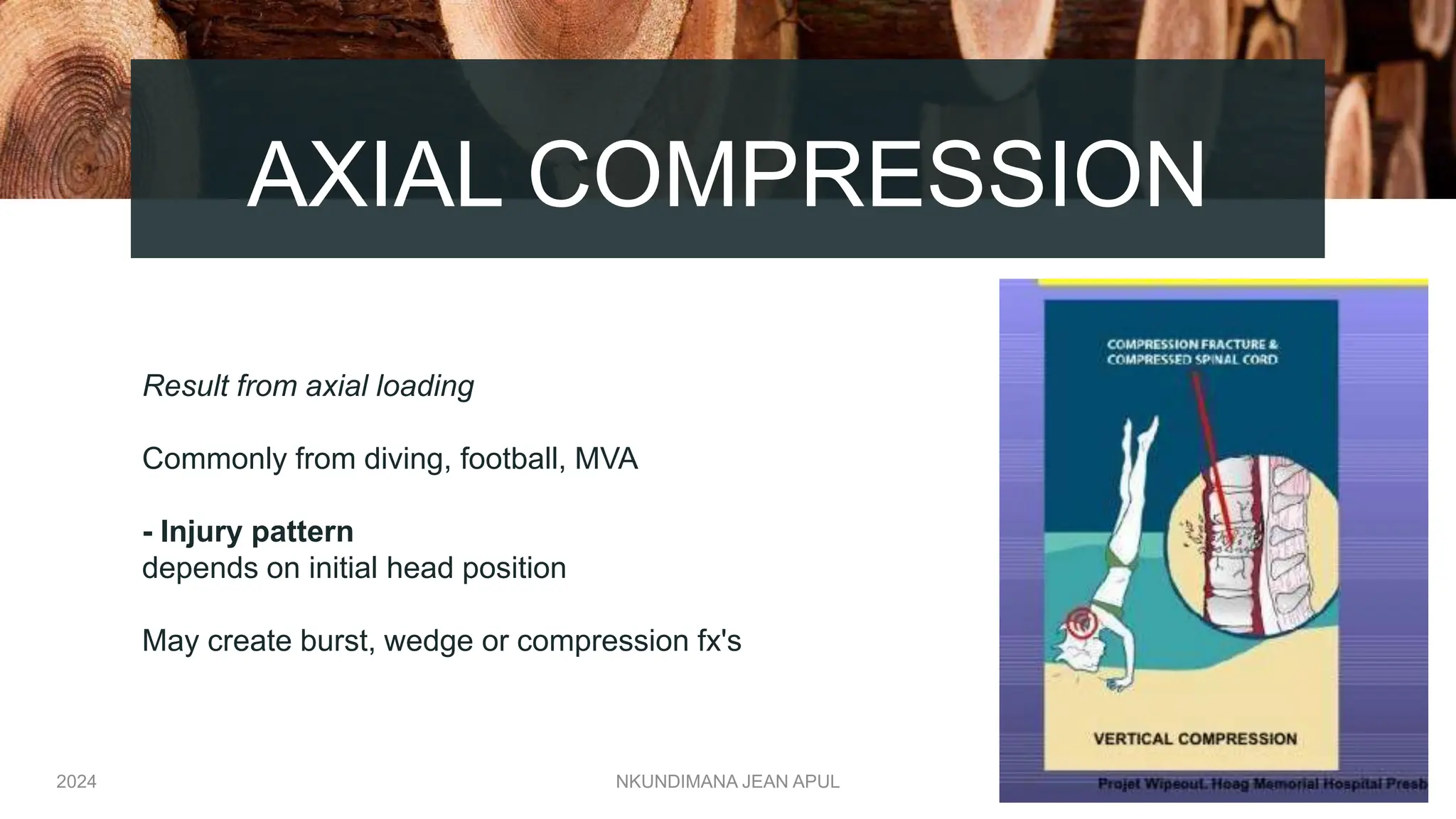 SUBAXIAL SPINE INJURY BY DR NKUNDIMANA JEAN PAUL .pptx