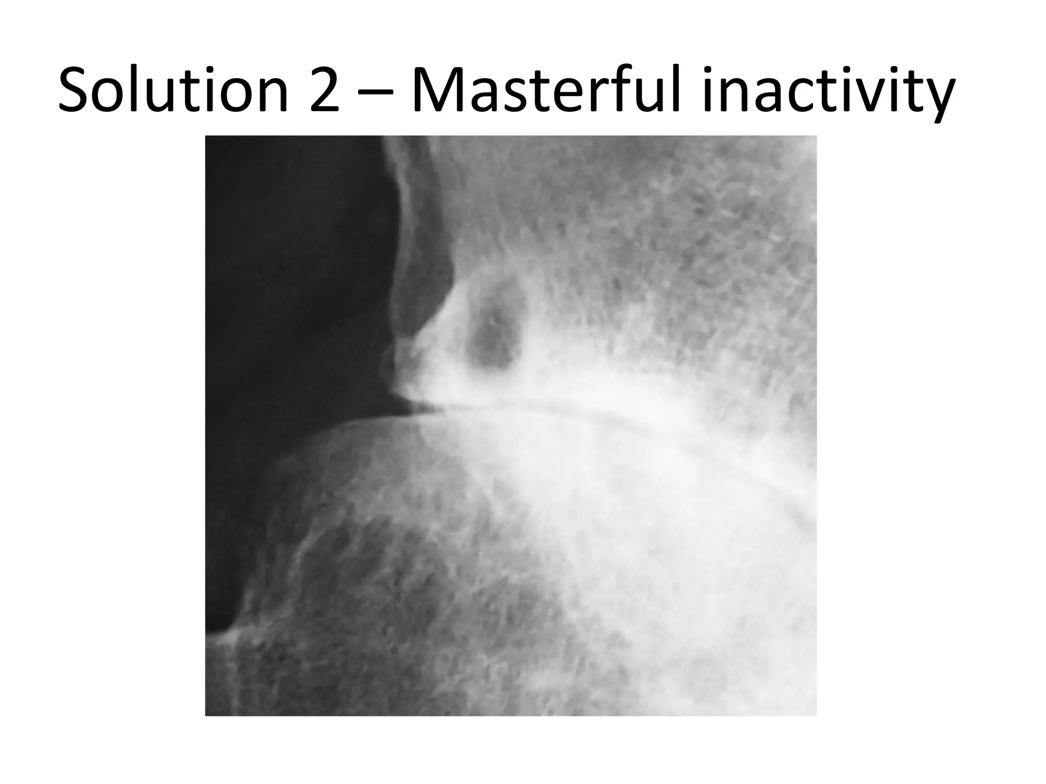 Subchondral cysts | PPT | Free Download