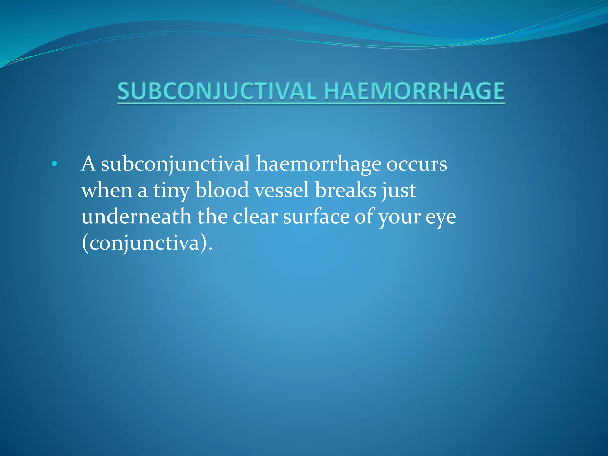 Subconjuctival haemorrhage | PPTX