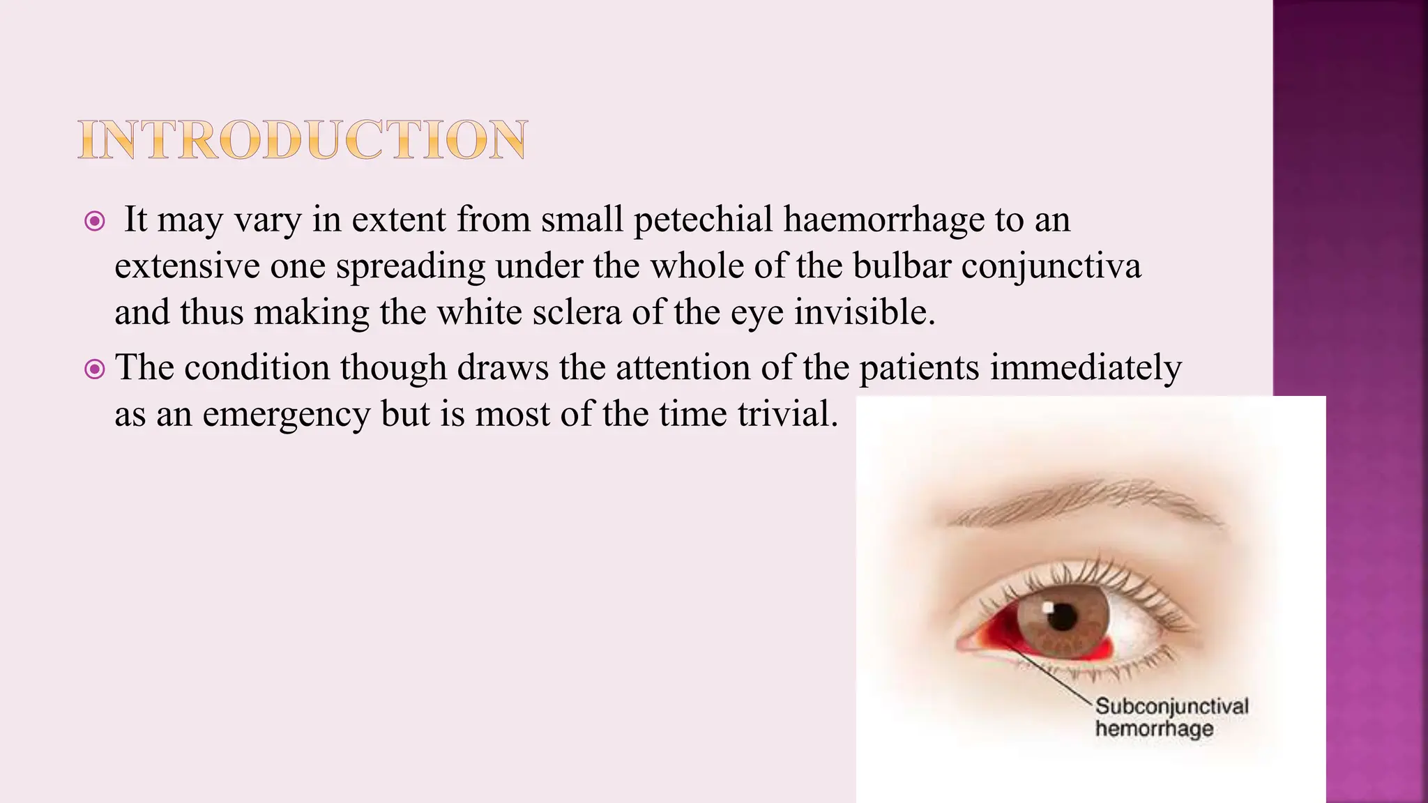 Subconjunctival Haemorrhage,causes,treatment..pptx