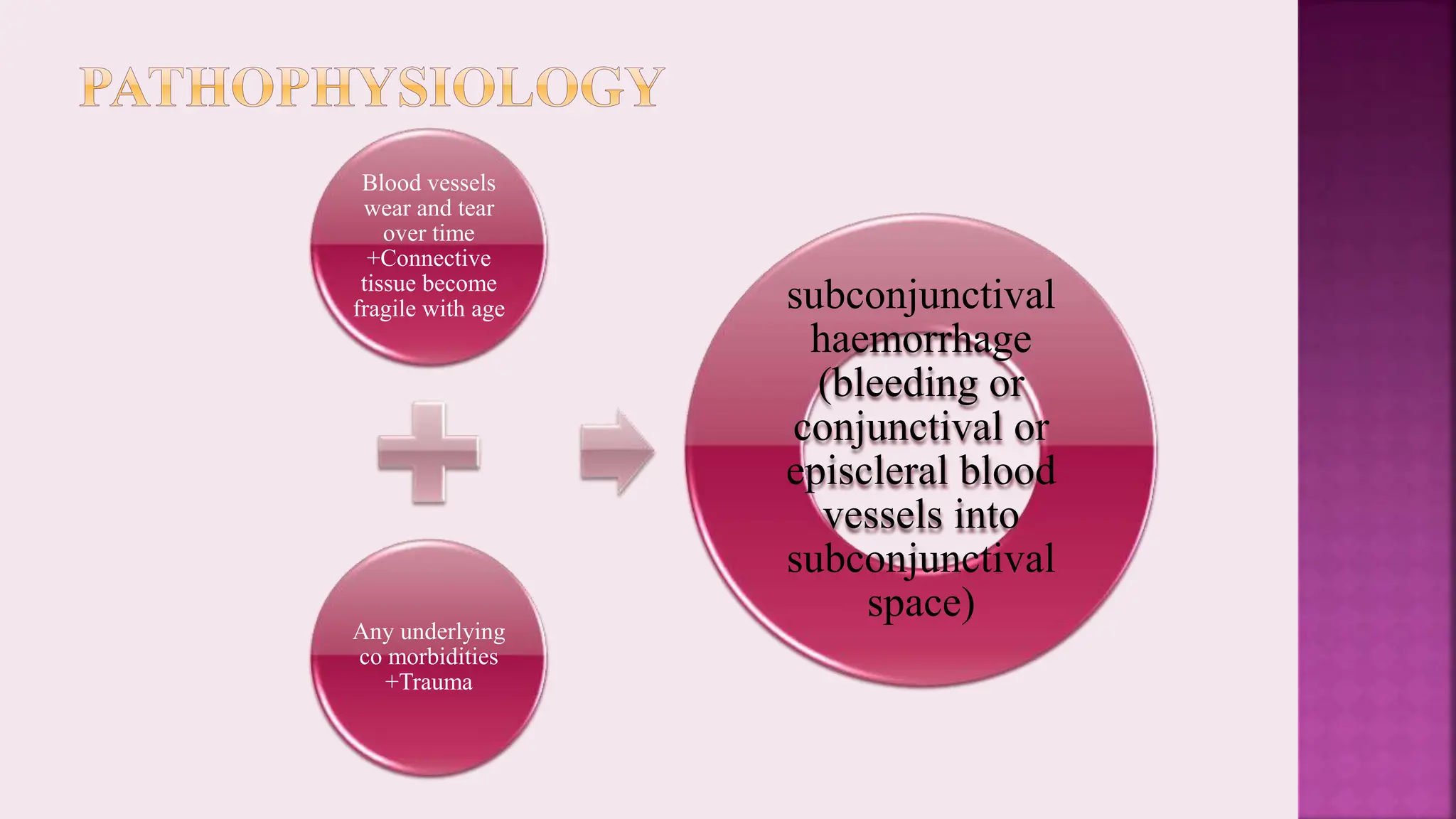 Subconjunctival Haemorrhage,causes,treatment..pptx