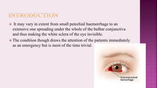 Subconjunctival Haemorrhage,causes,treatment..pptx