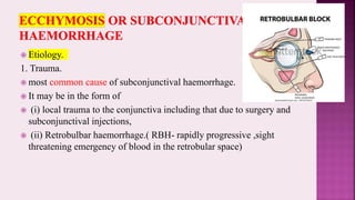 Subconjunctival Haemorrhage,causes,treatment..pptx | Eye and Vision ...