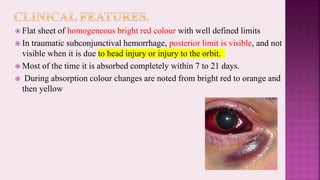 Subconjunctival Haemorrhage,causes,treatment..pptx