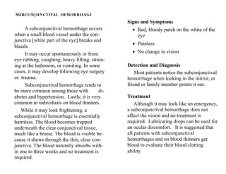 Subconjunctival Hemorrhage Diagram