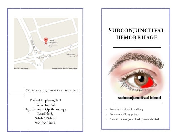 Subconjunctival hemorrhage by Dr. Michael Duplessie Eye Doctor