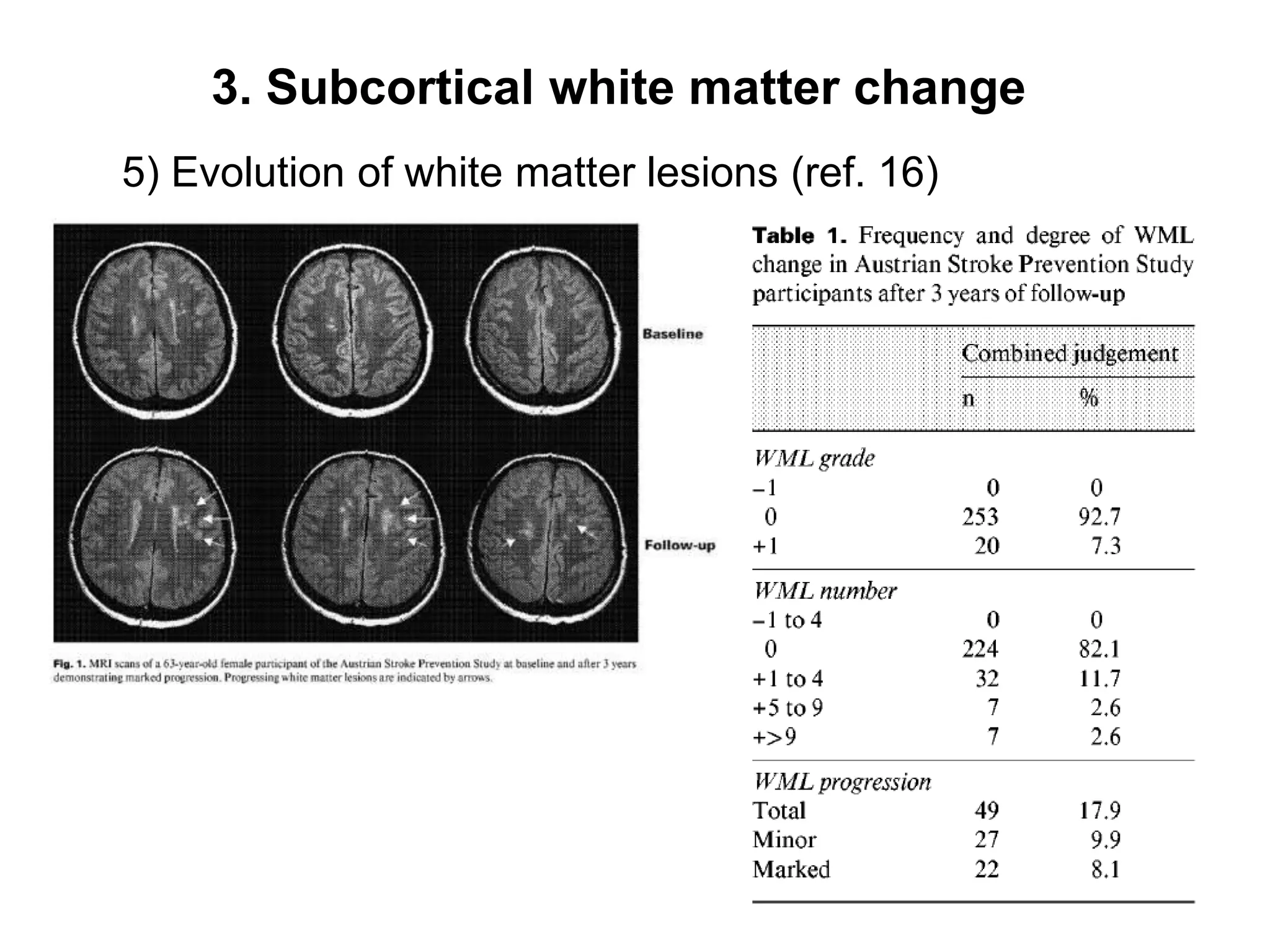 Subcortical lesion-classification-presentation-2011-10-10 | PPTX