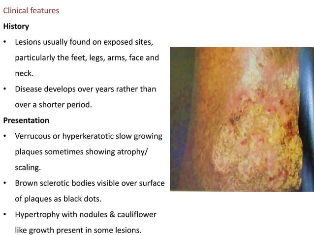 SUBCUTANEOUS AND FUNGAL INFECTIONS | PPTX | Skin and Dermatology ...