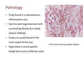 SUBCUTANEOUS AND FUNGAL INFECTIONS | PPTX