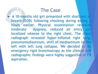 Subcutaneous Emphysema due to Thick Bronchial Secretions.pdf