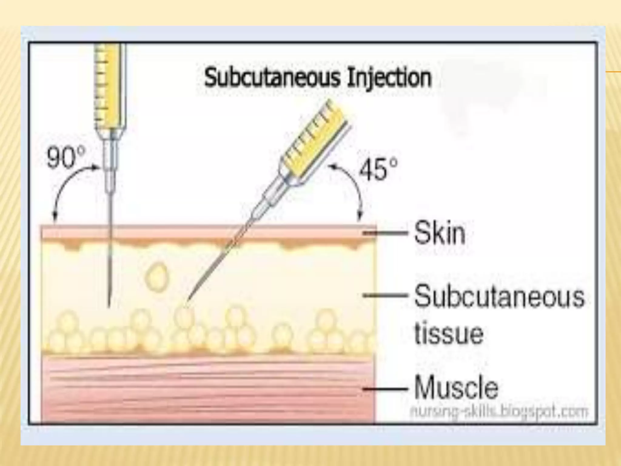 Subcutaneous injection | PPTX