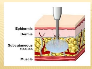 Subcutaneous injection | PPTX