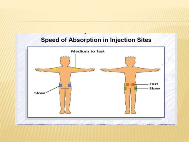 Subcutaneous injection
