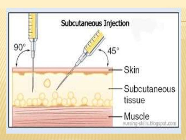 Subcutaneous injection