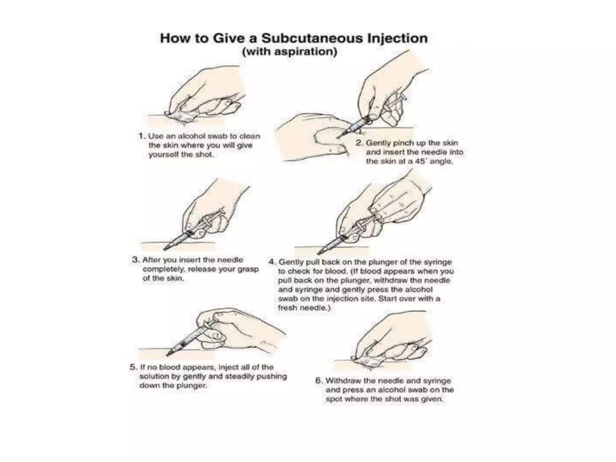 Subcutaneous injection.pptx