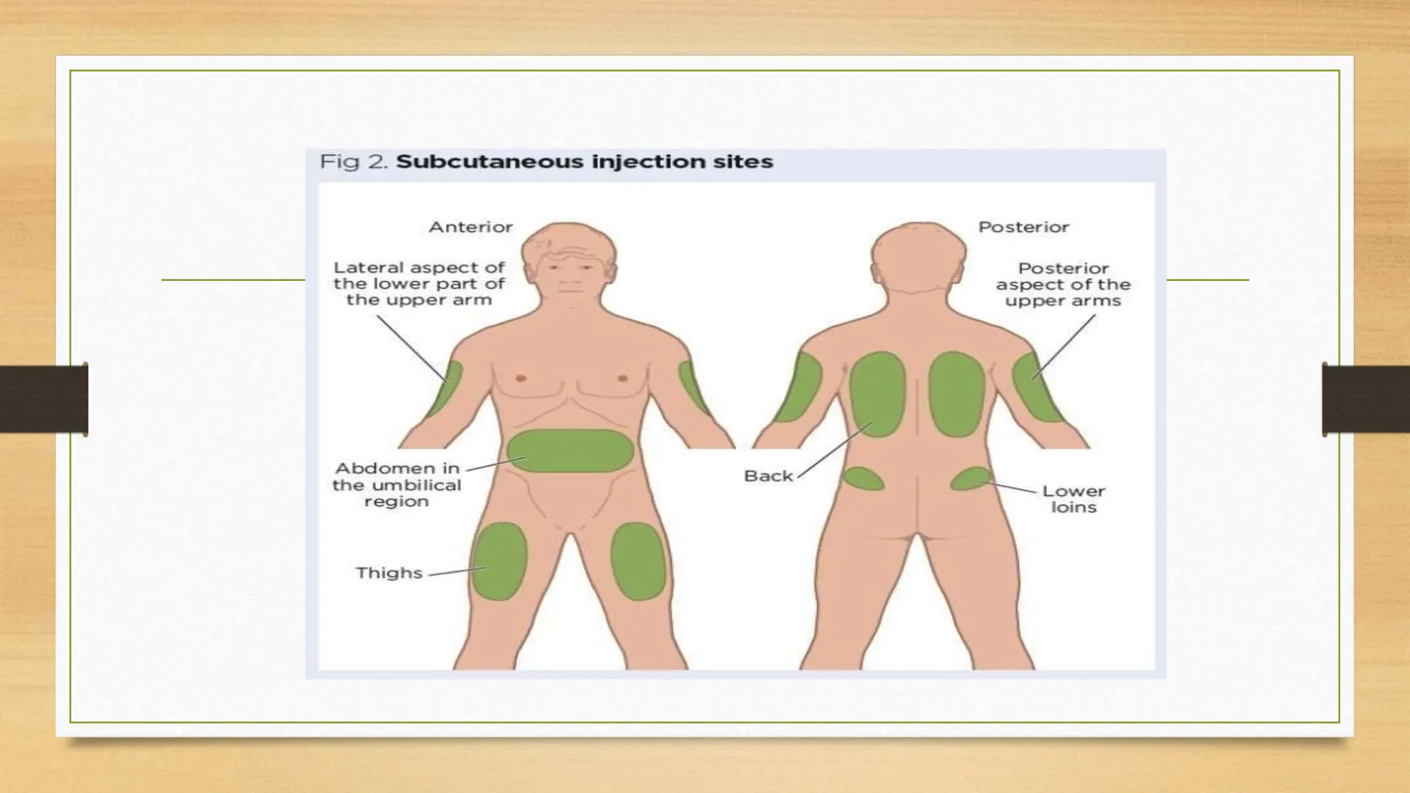 Subcutaneous Injections.pptx Nursing students | PPTX