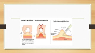 Subcutaneous Injections.pptx Nursing students | PPTX