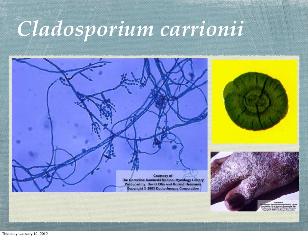 Subcutaneous mycoses