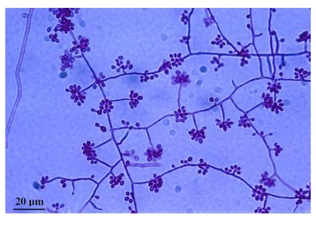 Subcutaneous mycoses