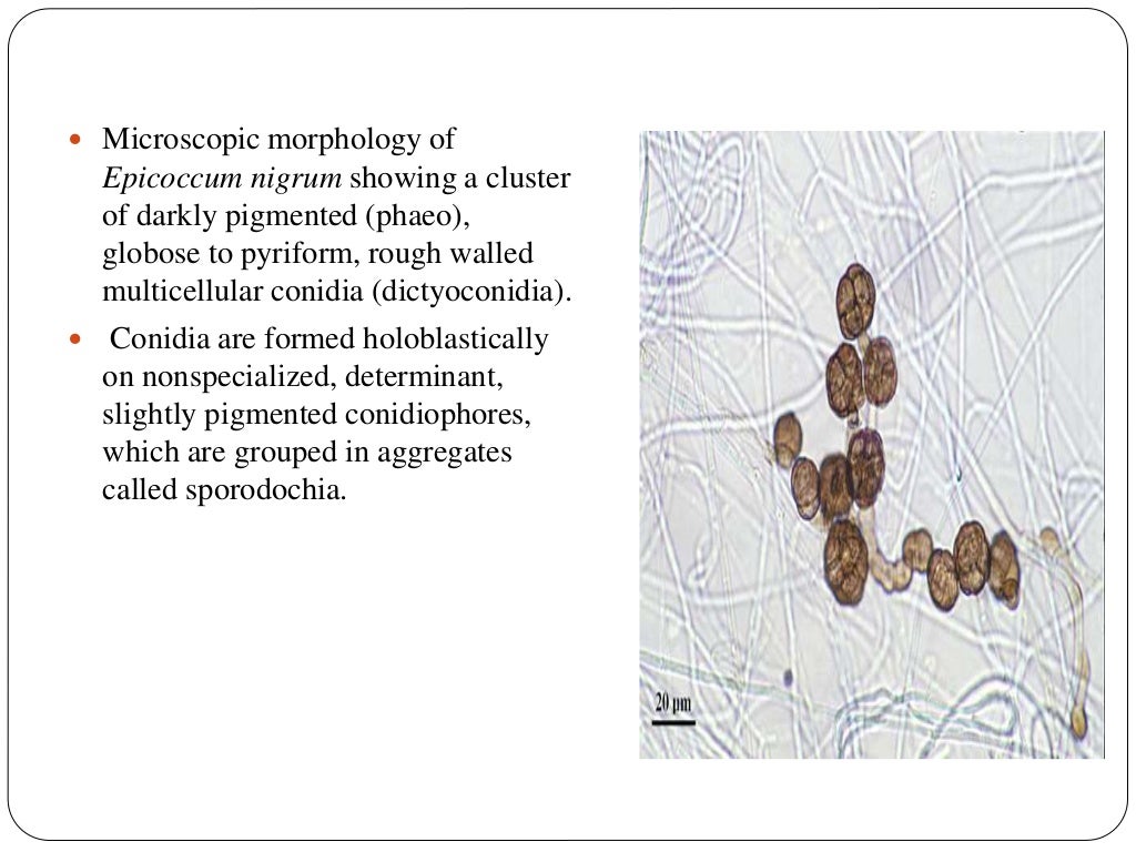 Subcutaneous mycoses
