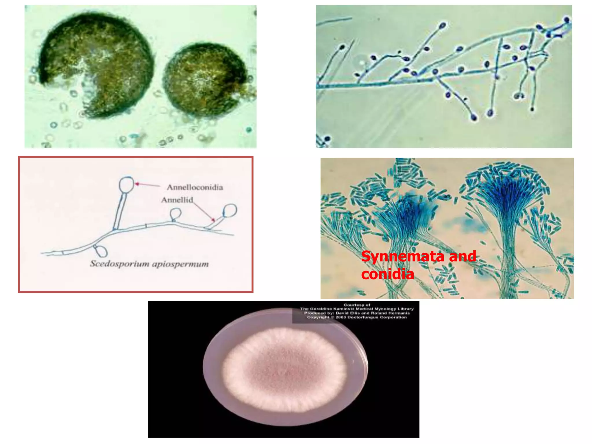 Subcutaneous mycoses.ppt