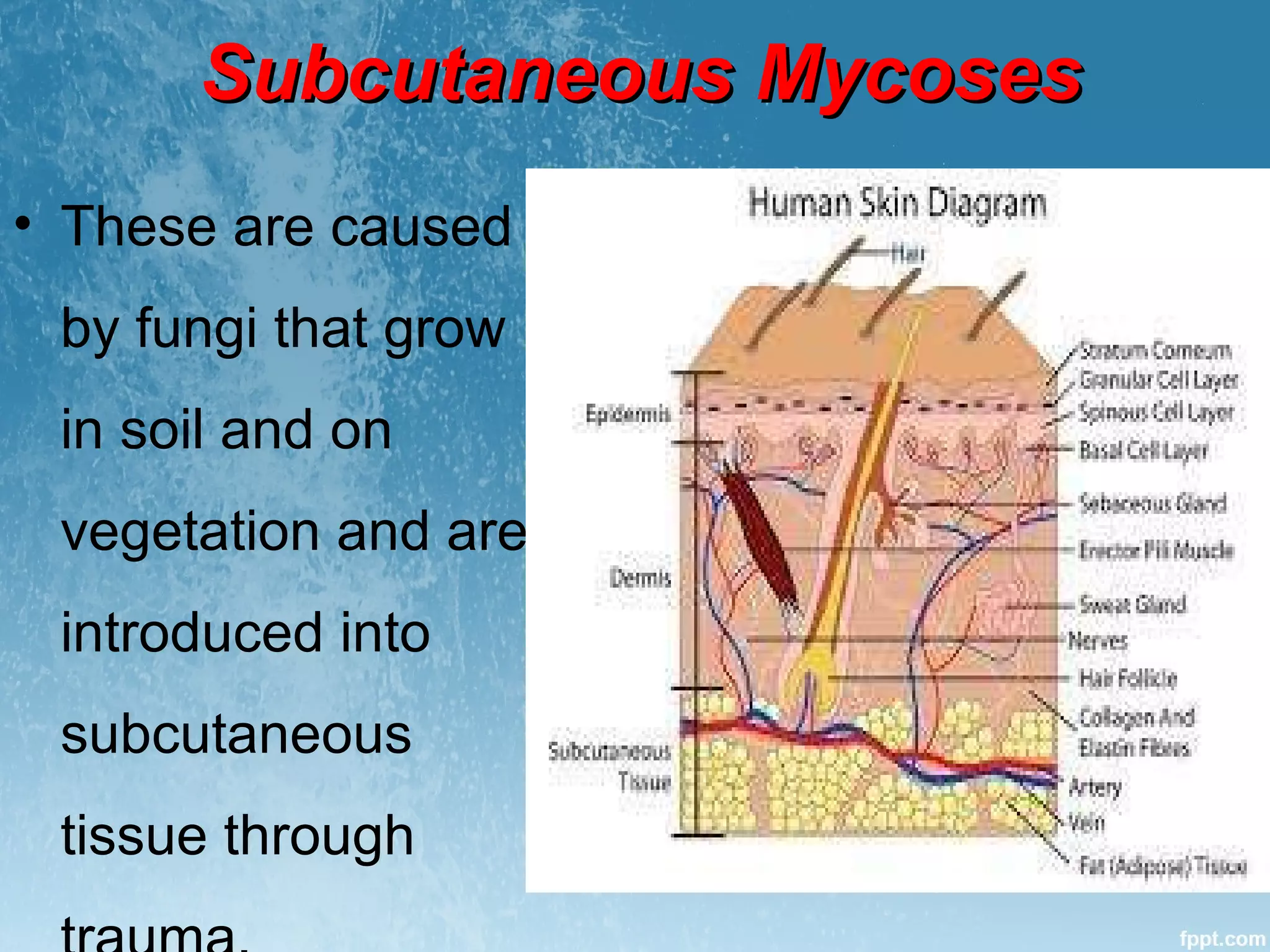 Subcutaneous mycoses by Dr. Rakesh Prasad Sah | PPT