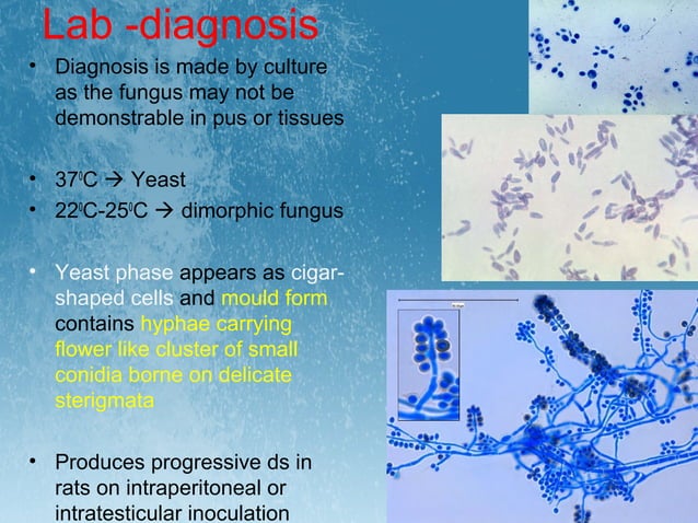 Subcutaneous mycoses by Dr. Rakesh Prasad Sah | PPT