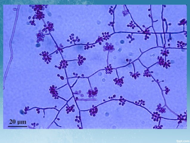 Subcutaneous mycoses by Dr. Rakesh Prasad Sah | PPT