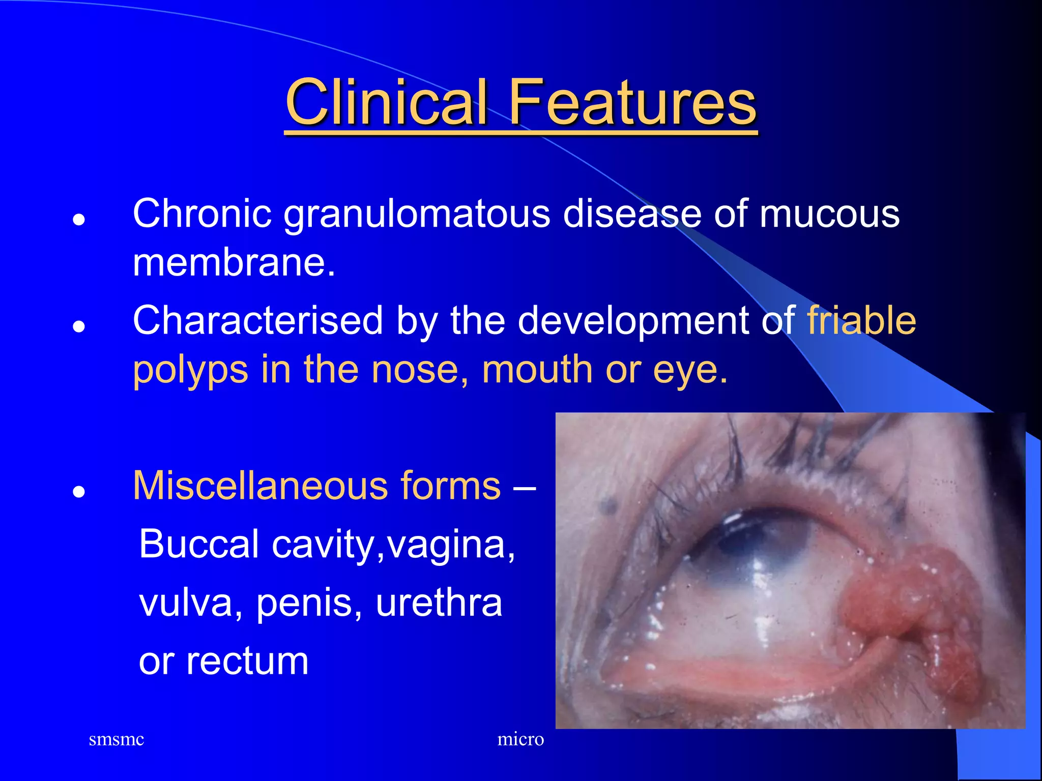 Subcutaneous mycoses | PPT